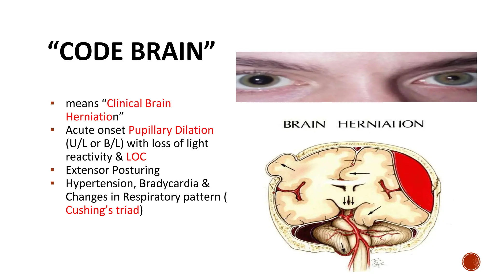 Head_injury (Traumatic Brain Injury).pptx