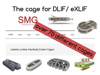 eXLIF or DLIF about 20 consecutive cases whit Ursus cages by Syntropiq ...