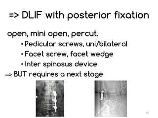 Lateral Lumbar Interbody Fusion : DLIF, XLIF with Lateral Fixation in ...