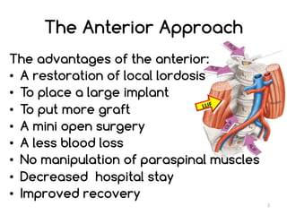 Lateral Lumbar Interbody Fusion : DLIF, XLIF with Lateral Fixation in ...