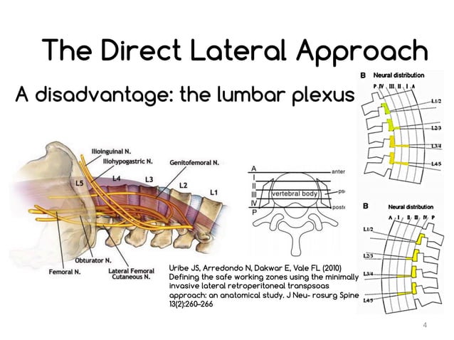 Lateral Lumbar Interbody Fusion : DLIF, XLIF with Lateral Fixation in ...