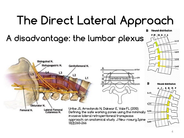 Lateral Lumbar Interbody Fusion : DLIF, XLIF with Lateral Fixation in…