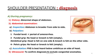 dlIlDGMCDGN5Sp1Y131.pptx