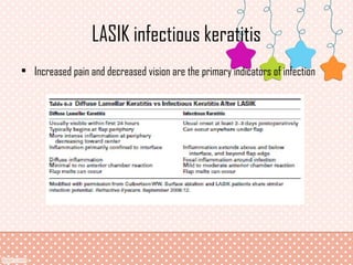 Diffuse Lamellar Keratitis (DLK) | PPT