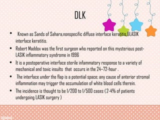 Diffuse Lamellar Keratitis (DLK) | PPT