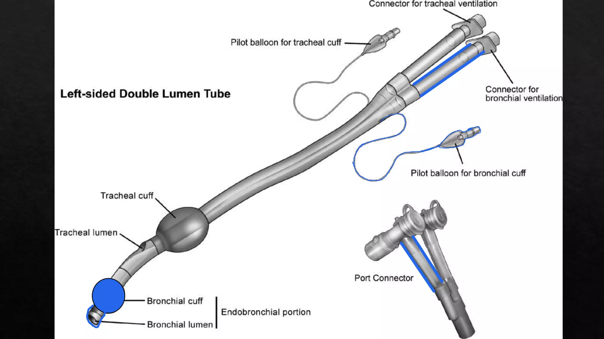 Double Lumen Tubes | PPTX