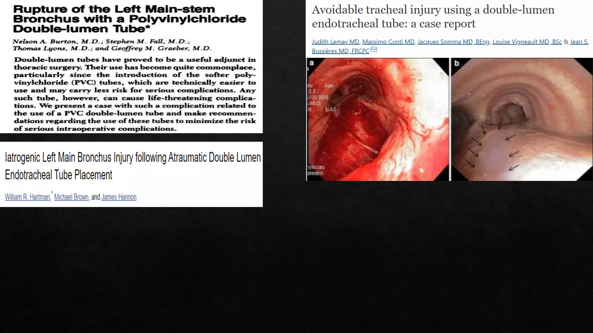 Double Lumen Tubes | PPTX