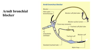 DLT & BB_anaesthesiaequipmentsandpracticle.pptx