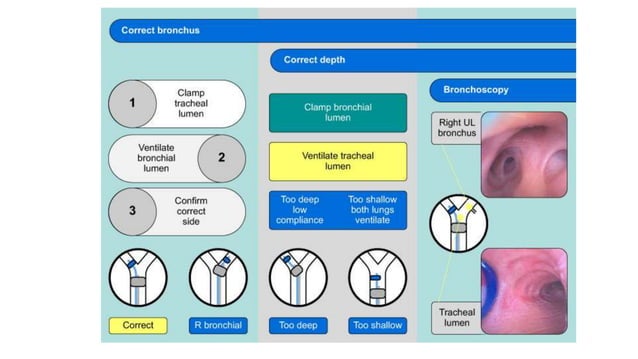 DLT & BB_anaesthesiaequipmentsandpracticle.pptx | Lung and Respiratory ...