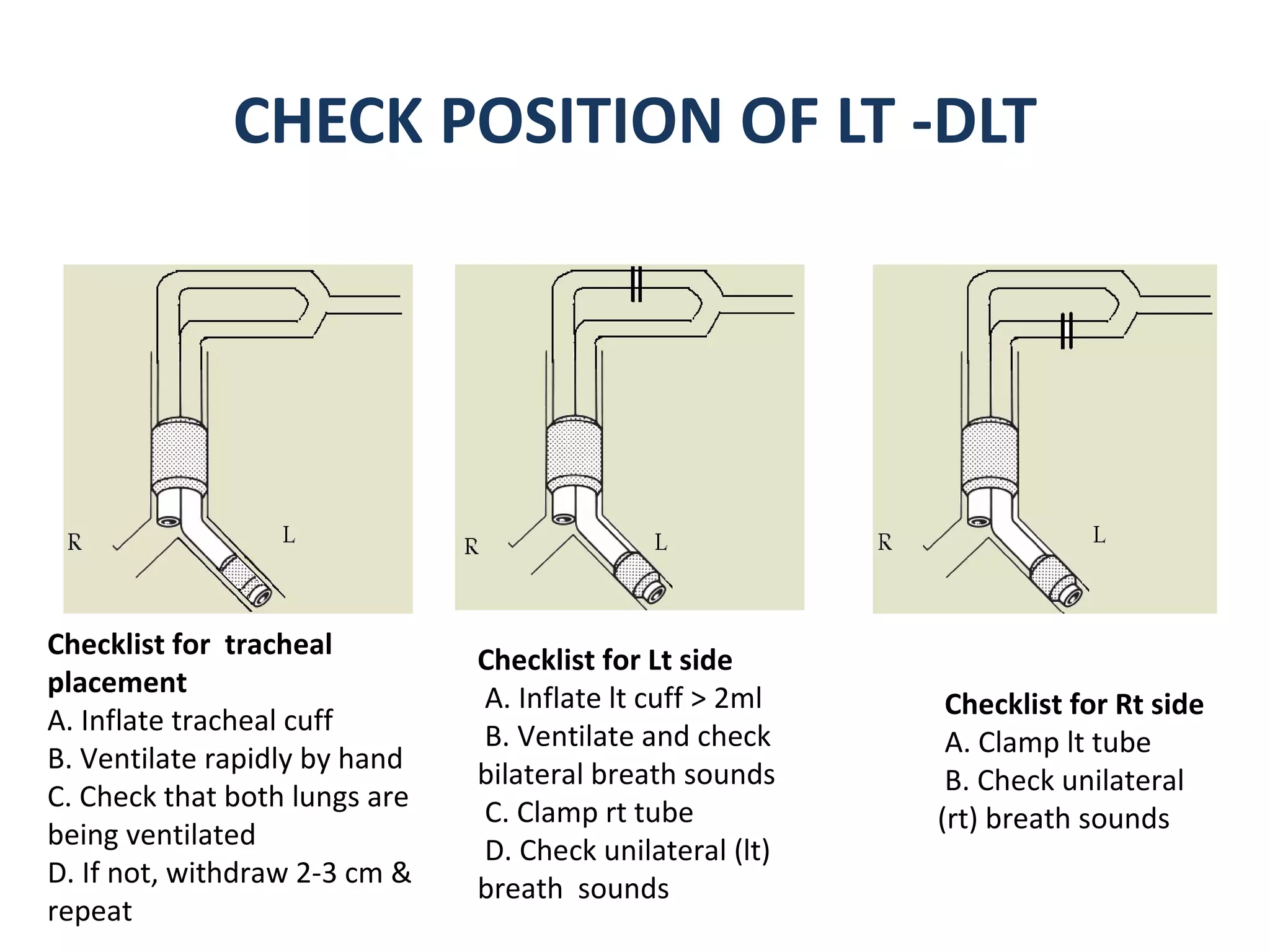 Double Lumen Endobronchial Tubes ppt | PPT