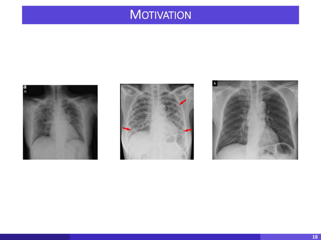 Deep Learning Use Cases using OpenPOWER systems | PPT