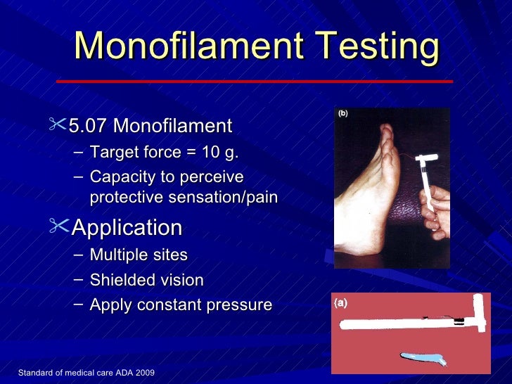 Diabetic mellitus 02