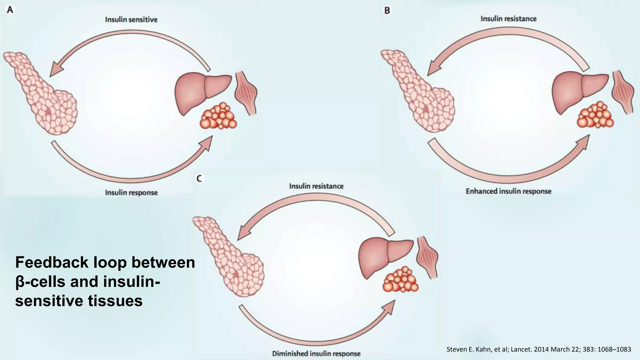 Type 2 Diabetes Mellitus - Pathophysiology | PPTX