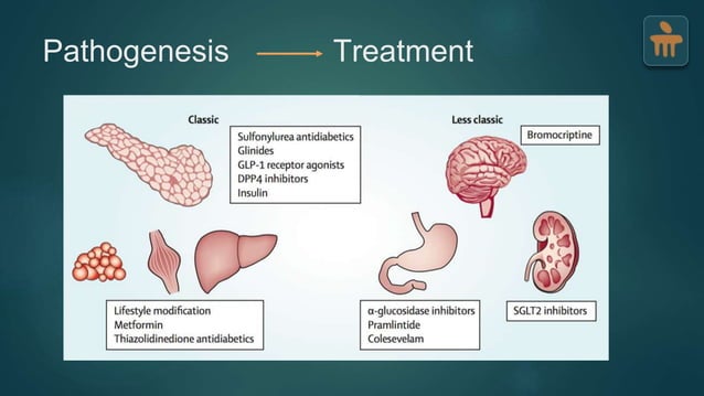 Type 2 Diabetes Mellitus - Pathophysiology | PPTX | Endocrine and ...
