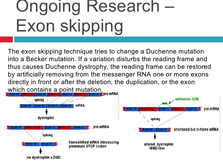 Duchenne Muscular Distrophy
