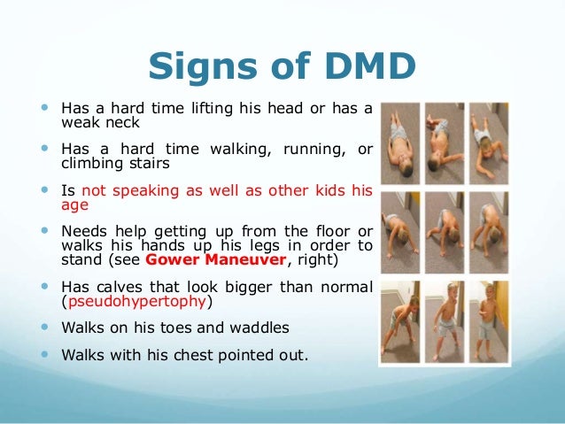 Gene therapy for muscular dystrophy