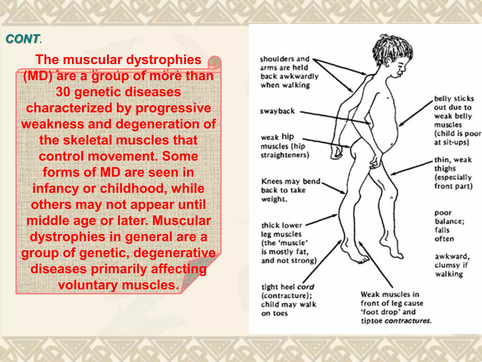 Duchenne's Muscular Dystrophy and Gene Therapy | PPTX
