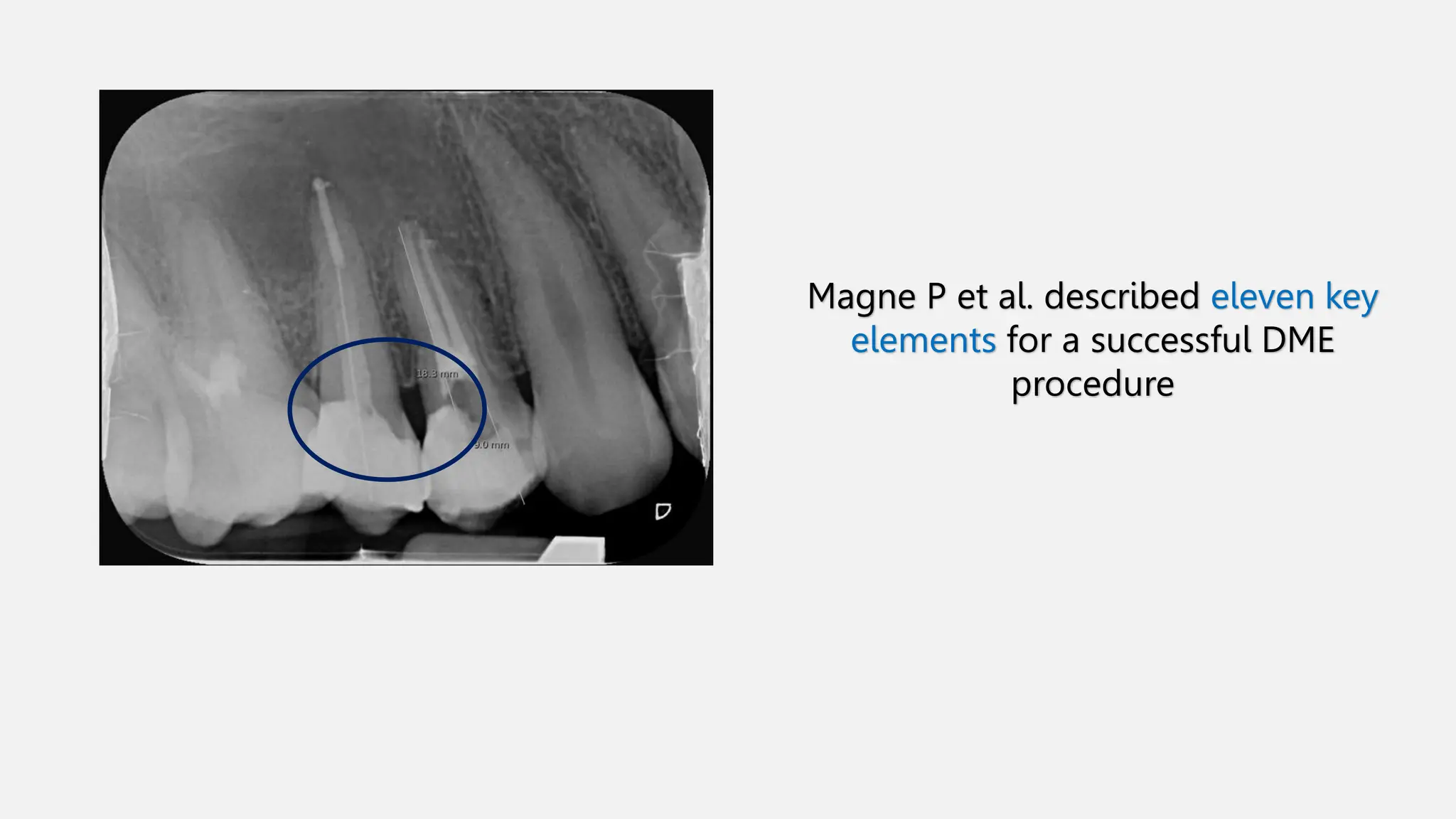 DME deep margin elevation brief ppt.pptx