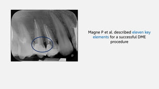 DME deep margin elevation brief ppt.pptx