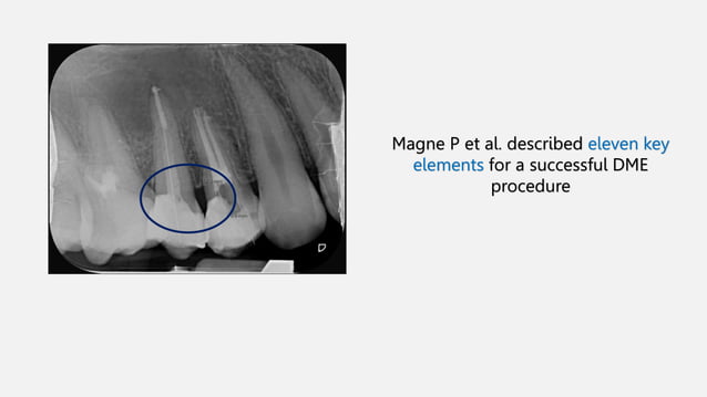DME deep margin elevation brief ppt.pptx | Oral care | Personal Care