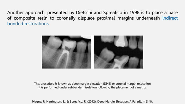 DME deep margin elevation brief ppt.pptx | Oral care | Personal Care
