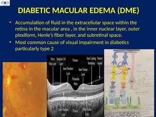 DIABETIC MACULAR EDEMA . RETINA . DIAGNOSIS . MANAGEMENT | PPTX