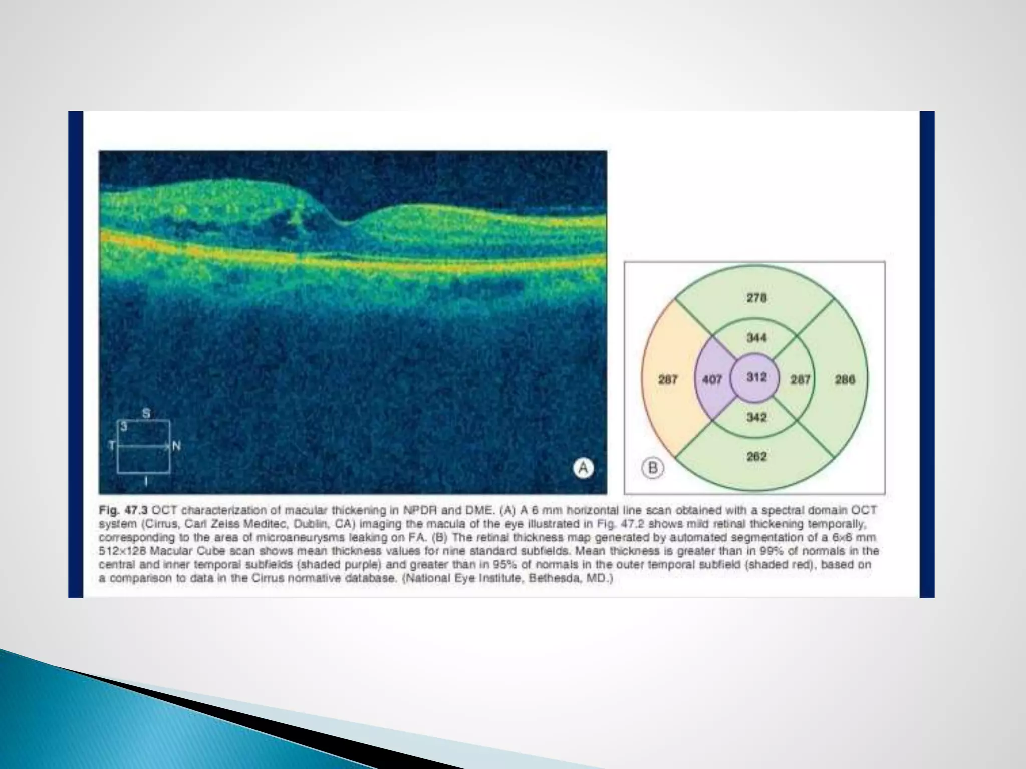 DME Management Guidelines | PPTX