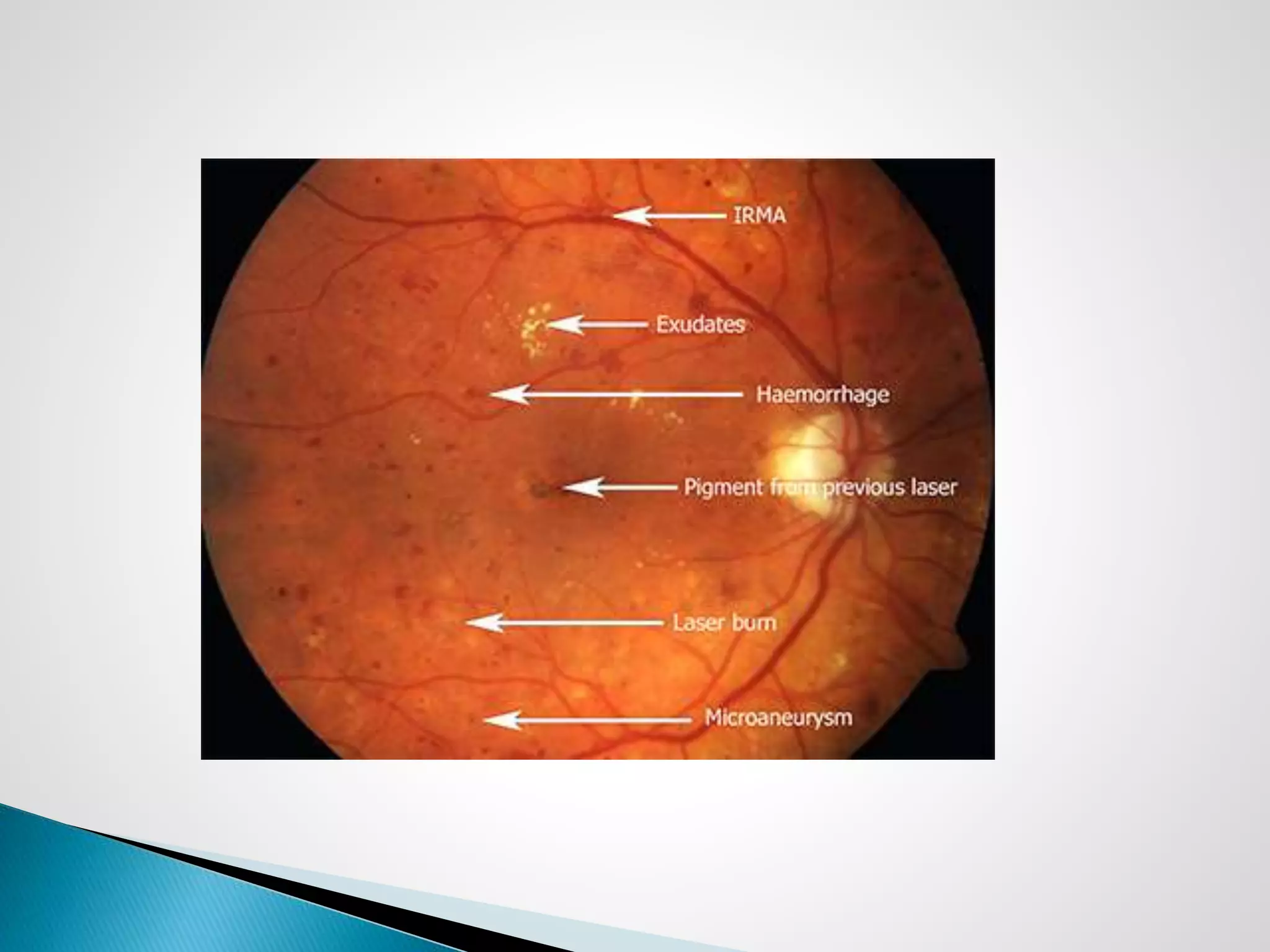 DME Management Guidelines | PPTX