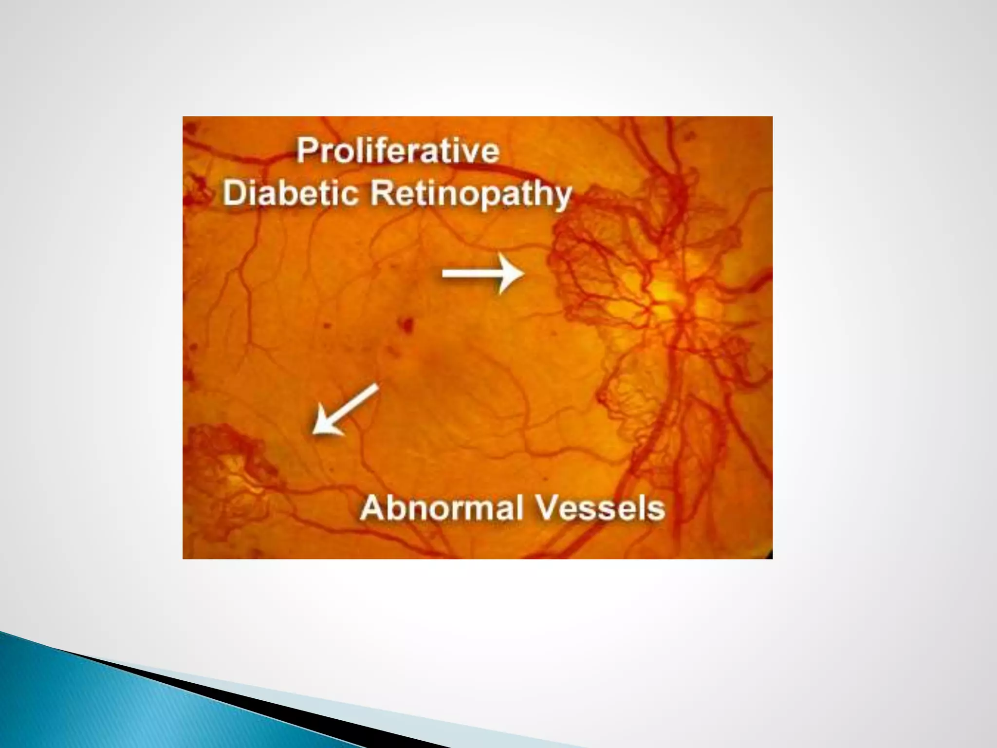 DME Management Guidelines | PPTX