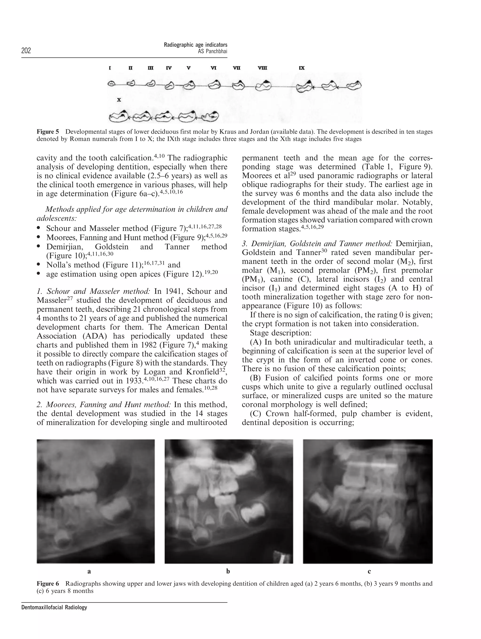 Dental radiographic indicators, a key to age estimation | PDF