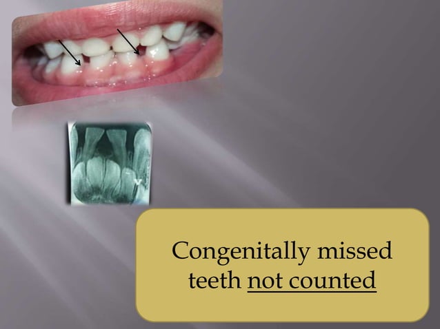 DMF for master degree and doctorate .pptx