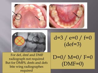 DMF for master degree and doctorate .pptx