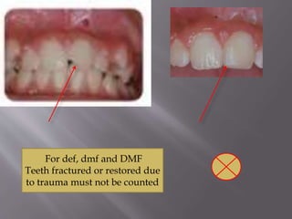 DMF for master degree and doctorate .pptx