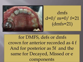 DMF for master degree and doctorate .pptx