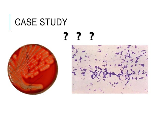 Microbiology of diabetic foot infections | PPTX