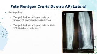 DM_K39_Dafa Azmi Syauqi Shihab_ Laporan kasus.pptx