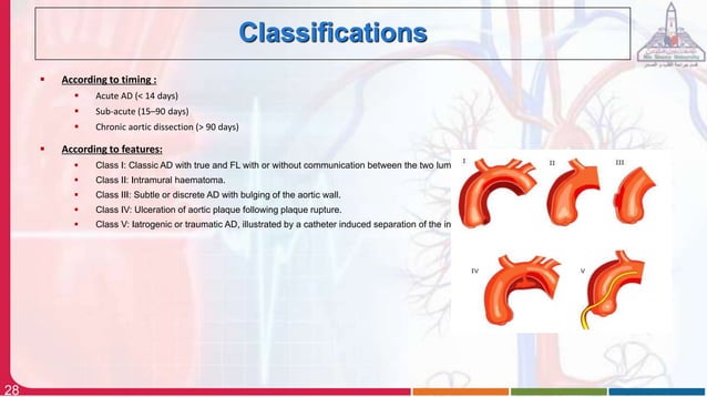 Aortic Diseases Ain Shams Post graduate CTS Course | PPT