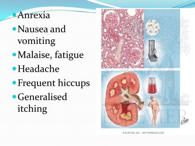 Dm nephro pathy | PPT