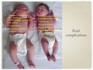 Sacral Agenesis Pregnancy