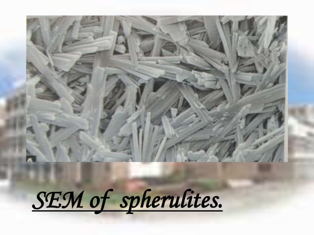 Setting expansion of Gypsum | PPTX