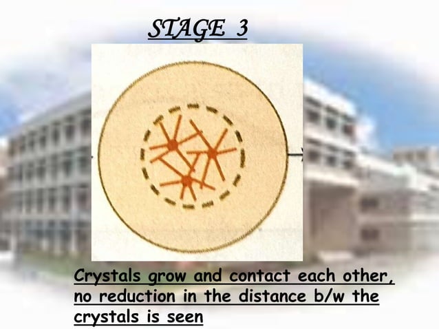 Setting expansion of Gypsum | PPTX