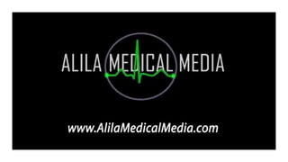 Diabetes mellitus ( DM) Presentation ppt | PPT