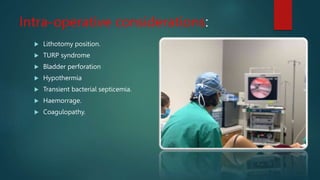 TURP case presentation.pptx