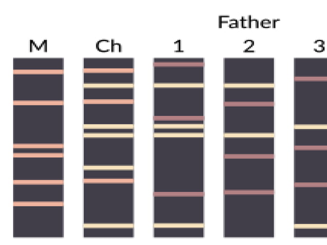 Forensic Dna Profiling Pptx Genealogy And Ancestry Hobbies And Interests