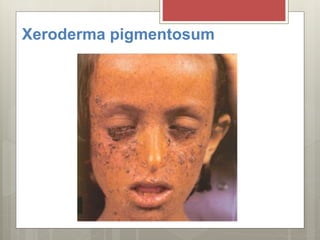 DNA damage and repair | PPTX