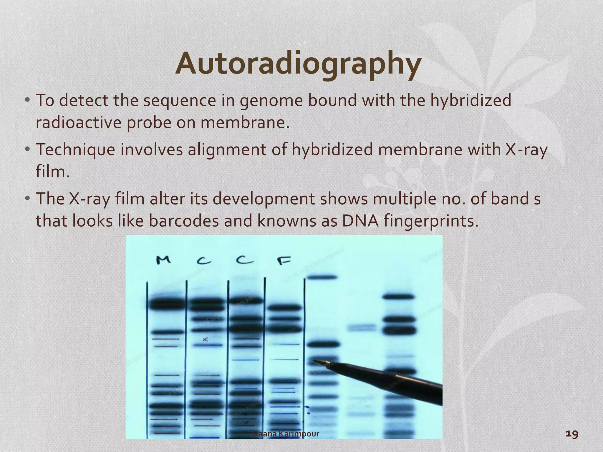 Dna finger printing | PPTX