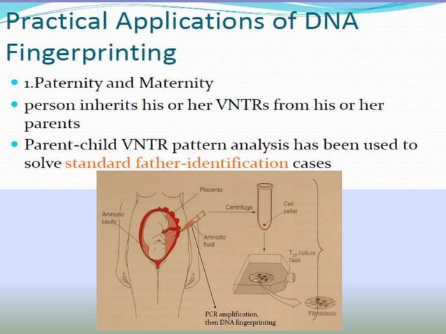 Dna finger printing | PPT