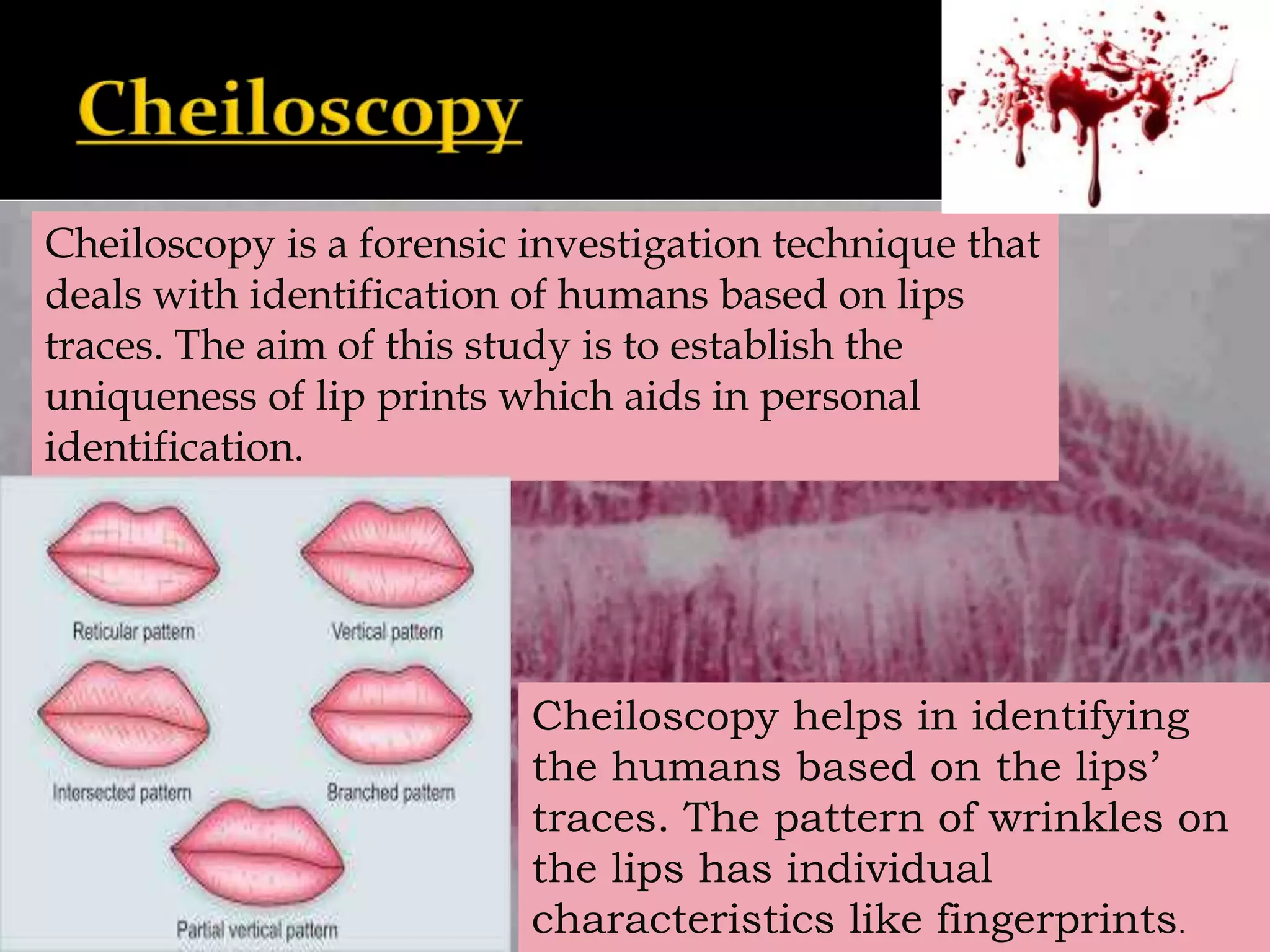 Dna fingerprinting the future of forensic dentistry | PPTX
