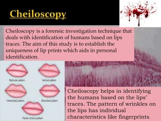 Dna fingerprinting the future of forensic dentistry | PPTX