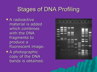 DNA Fingerprinting | PPT